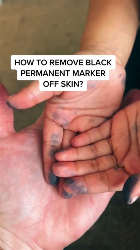 HOW TO REMOVE BLACK PERMANENT MARKER OFF SKIN HOW DO I DO THIS Please Drop Your Tips Tricks I