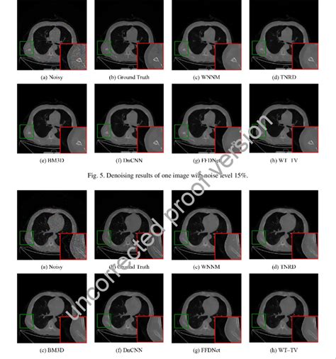 Denoising Results Of One Image With Noise Level Download Scientific Diagram