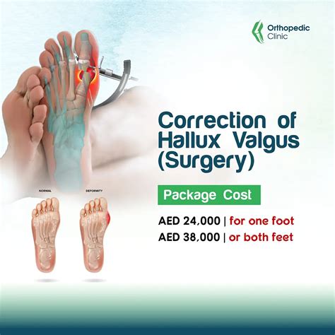 Cost Of Hallux Valgus Correction Surgery Dubai Orthopedic Clinic
