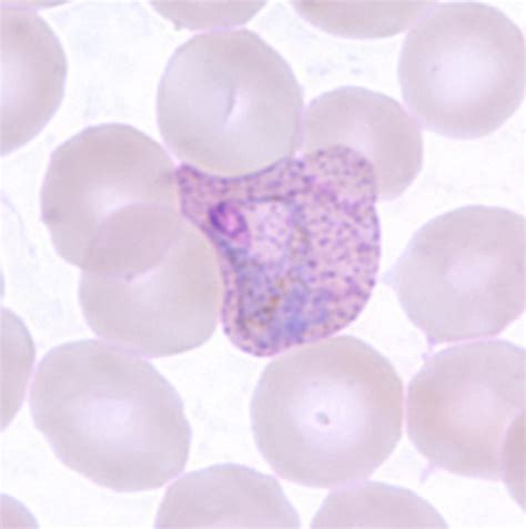 Plasmodium Vivax Trophozoite Amoeboid Form