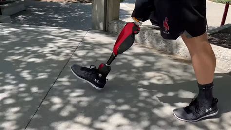 University Of Utah Developed The Most Advanced Ai Powered Prosthetic