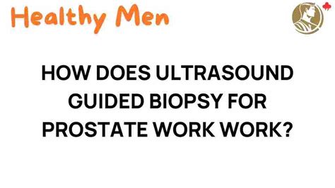 Unlocking The Secrets How Ultrasound Guided Biopsy For Prostate Works