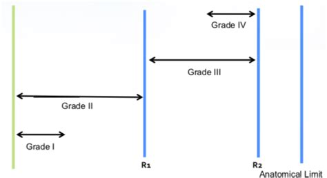 Joint Mobilizations Ther Ex Flashcards Quizlet