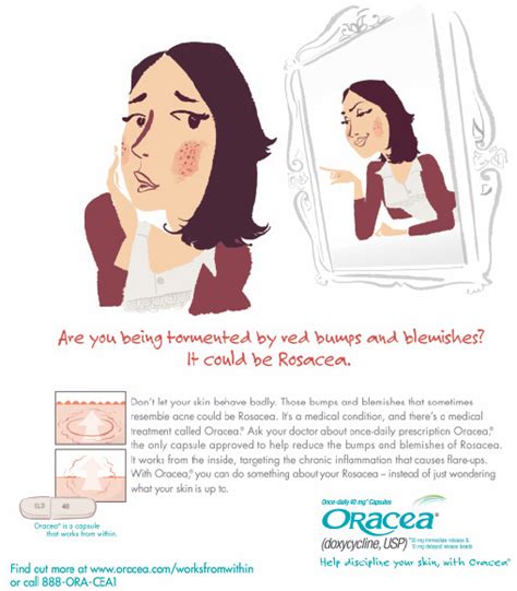 Oracea Wins Award For Cute Marketing Rosacea Support Group