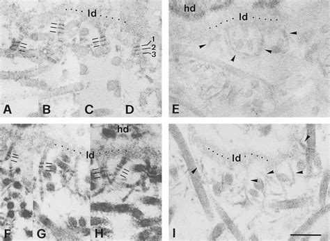 Ultrastructural Localization Of Transglutaminase Cross Linking Sites On