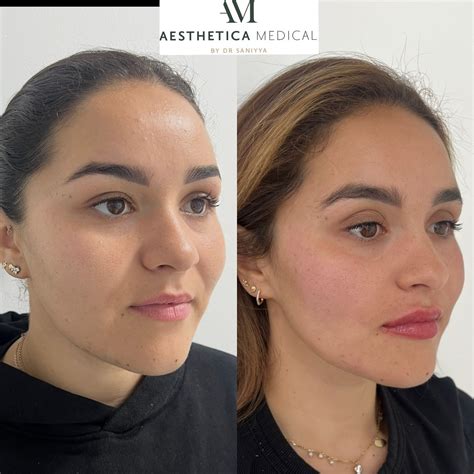 Aesthetica Medical The Best Kind Of Feedback Theres So Much More To