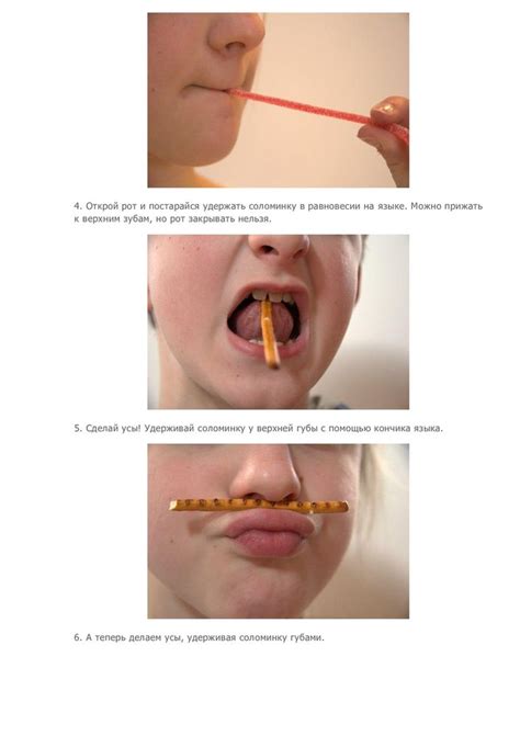 Школа молодого логопеда ВКонтакте