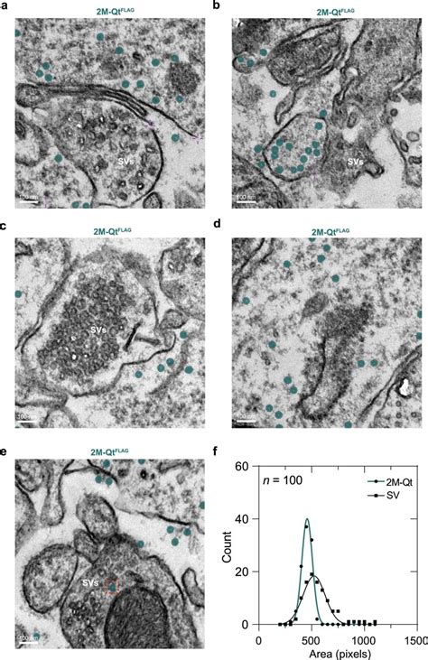 Additional Tem Micrographs From Emcapsulins Expressed In Mouse Download Scientific Diagram