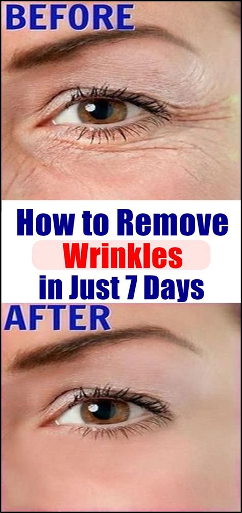 How To Remove Wrinkles Naturally In Just Days Holistic Life Course Wrinkle Remover Skin
