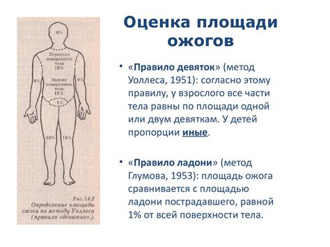 Ожоги глаз - презентация онлайн