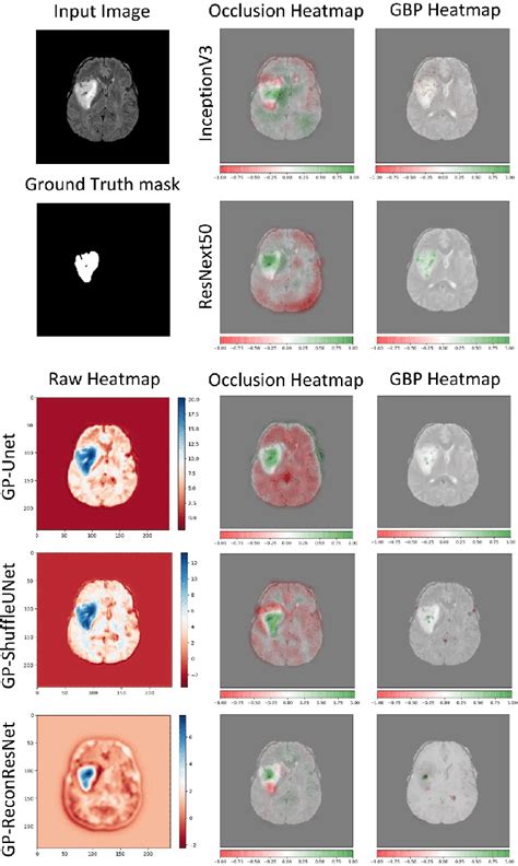 Figure 10 From Weakly Supervised Segmentation Using Inherently Explainable Classification Models