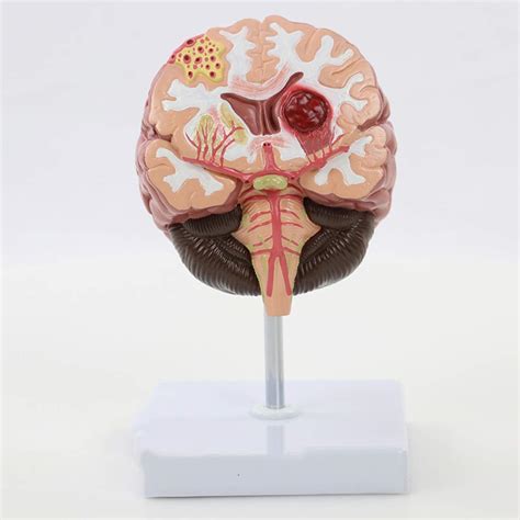 Buy Educational Model Medical Human Brain Anatomical Model Human Brain Disease Model Brain