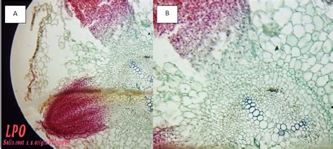 Bio421l Root Lateral Root Formation Of Salix Cross Section Diagram