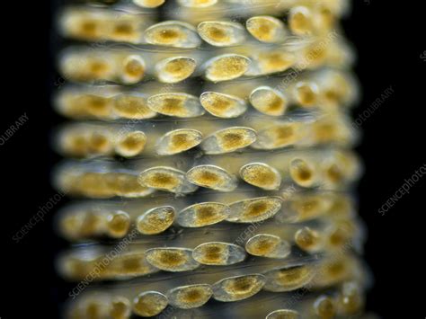 Midge Eggs Light Micrograph Stock Image C055 9632 Science Photo Library