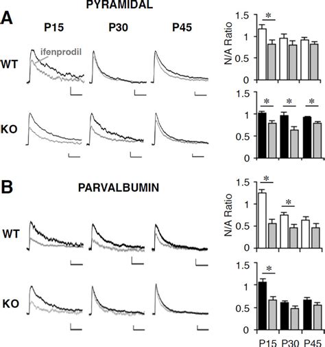Developmental Decrease In Nmdar Glun2b Expression Is Delayed In