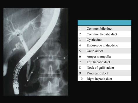 Gallbladder And Extrahepatic Biliary Tree Pptx Pregnancy