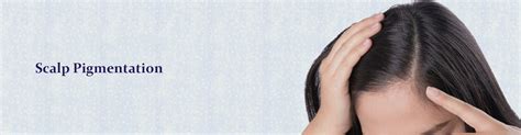 Scalp Pigmentation