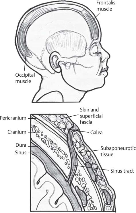 Scalp Lesions Neupsy Key