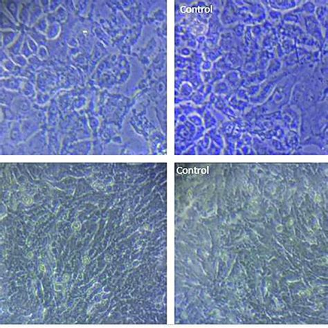Morphology Of The Control Cell Line Of Mcf7 Row 1 And Huvec Cell Download Scientific Diagram