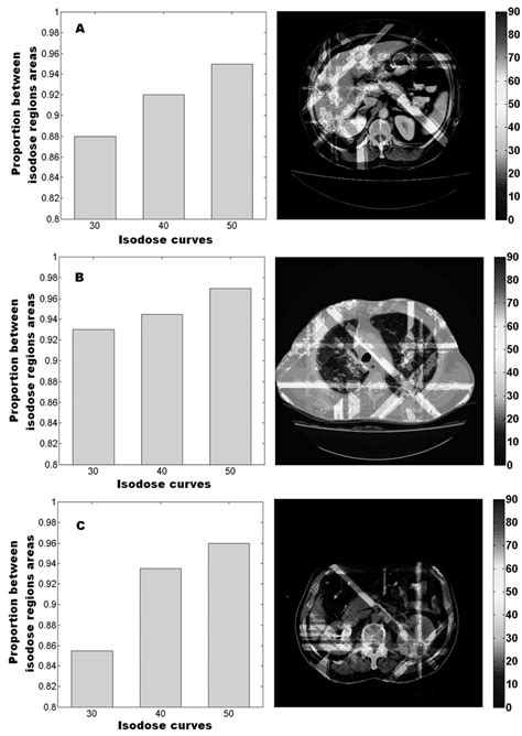 proportion between isodose regions areas respectively for the images download scientific