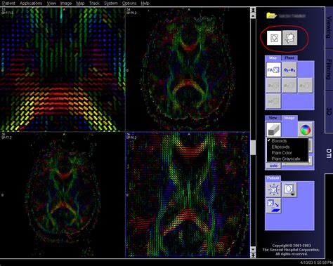 Dti Task Card Tensor View