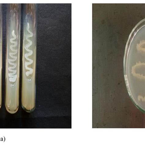 Gc Ms Chromatogram Of Xylene Degradation Download Scientific Diagram