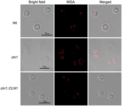 Binding Of Wheat Germ Agglutinin To C Neoformans Strains Panels Show Download Scientific