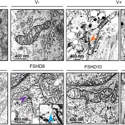 Mitochondrial Ultrastructure Abnormalities Are Observed In Download Scientific Diagram