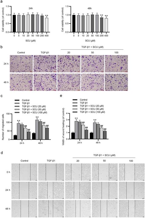 灯盏乙素通过 Mapk 和 Smad2 3 信号通路减轻卵清蛋白诱导的小鼠气道重塑和 Tgf β 诱导的人支气管上皮细胞促纤维化表型 Inflammation X Mol