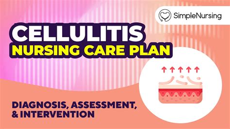 Cellulitis Nursing Care Plan Diagnosis Assessment Intervention