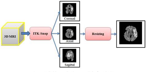 Figure 1 From Deep Learning Framework To Detect Ischemic Stroke Lesion In Brain Mri Slices Of