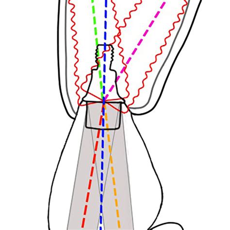 Measurements Related To The Angulation Of Abutment And The Angulation
