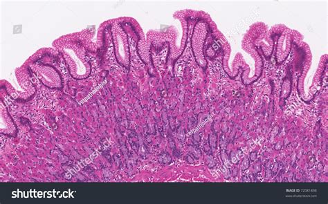 Parietal Cell Stomach Histology