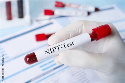 Noninvasive Prenatal Testing NIPT Nurse Holding Test Tube With Blood Sample In Laboratory