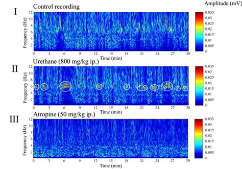 Automatic Detection Of Highly Organized Theta Oscillations In The