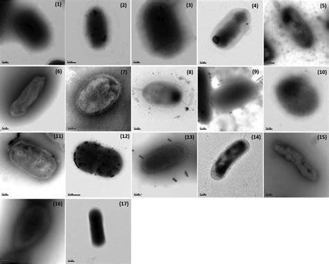 Transmission Electron Micrographs Of Cells Of The Strains Isolated In
