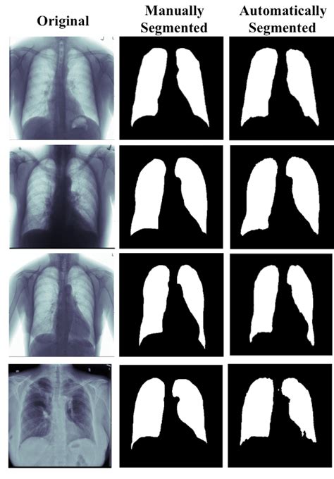 Examples Of Cnn Based Segmentation Results As Compared With The Manual