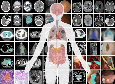 Segment Anything In Medical Images Pmc