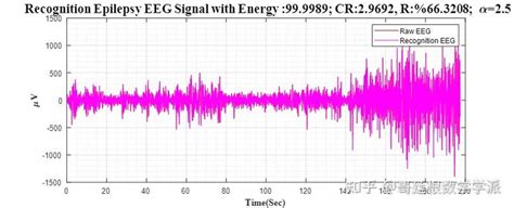 基于小波分析的癫痫脑电图检测 知乎