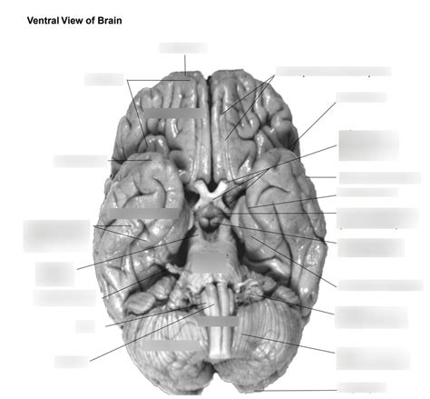 Ventral View Of Brain Diagram Quizlet