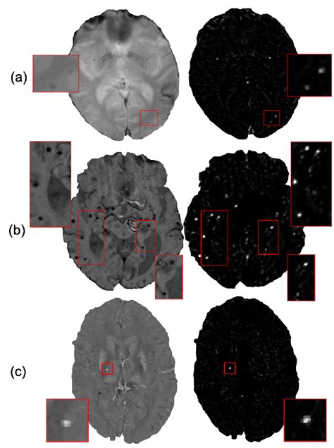 Examples Of The Final Fast Radial Symmetry Transform Frst Outputs For Download Scientific