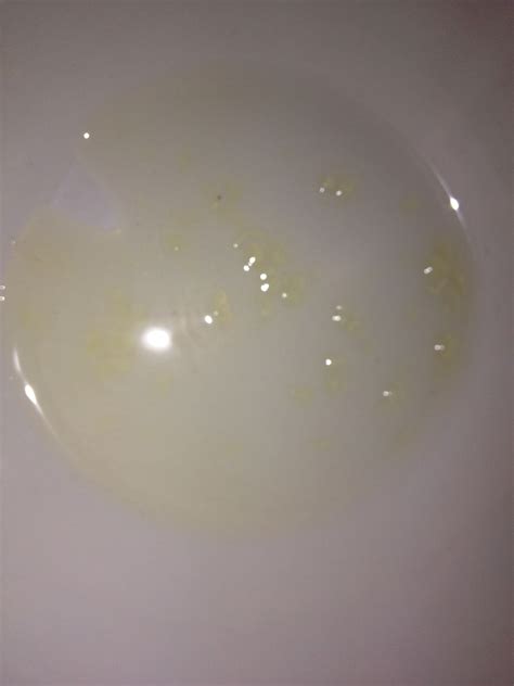 射精出来 有黄色的小果冻 这个症状 有时有有时没有 这样影响怀孕吗 还有液化是指跟水一样吗 百度宝宝知道
