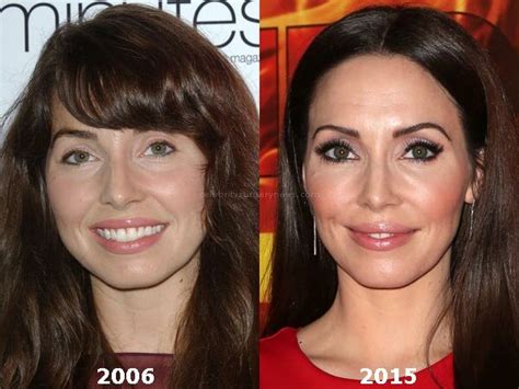 Whitney Cummings Plastic Surgery Before And After Celebrity Plastic