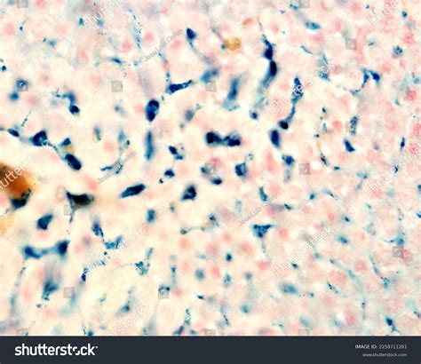 Lever Histologi Kupffer Celler The Role Of Kupffer Cells As Hepatic