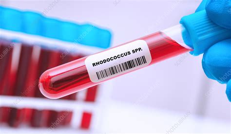 Rhodococcus Bacteria Stock Image F044 9802 Science Photo Library