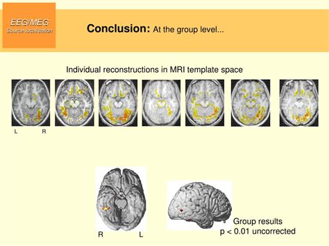 Ppt Eeg Meg Source Localisation Powerpoint Presentation Free Download Id 7090585