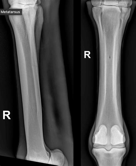 Equine Metacarpus Diagram Quizlet