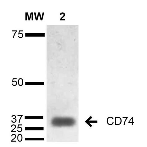 Cd74 Monoclonal Antibody 1b8 Apc Ma5 45378