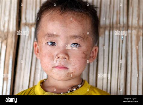 Portrait Of Asian Boy With A Dirty Face Stock Photo Alamy