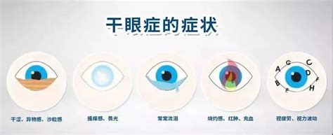 眼干眼涩还畏光专家别瞎滴眼药水试试这些方法 阿波罗新闻网